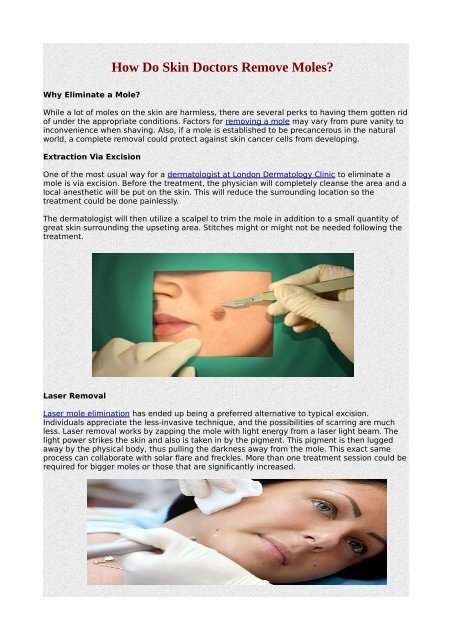 How Do Skin Doctors Remove Moles?