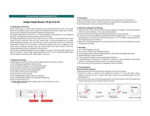 Anigen Rapid Bovine TB Ab Test Kit