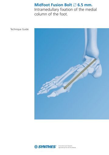 MatrixMANDIBLE. The next generation mandible plating ... - Synthes