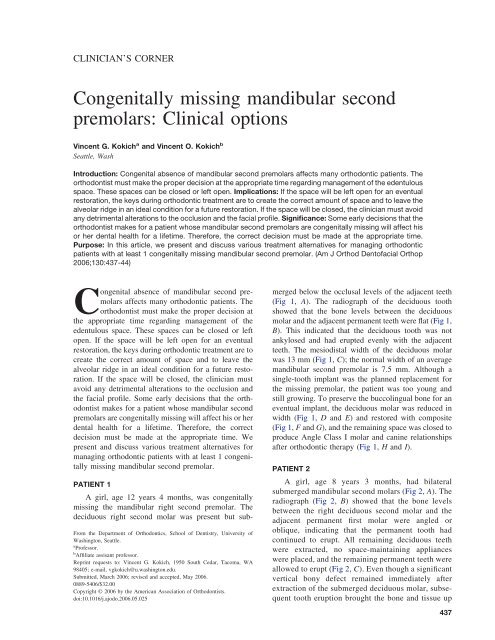 Congenitally missing mandibular second premolars ... - DentalXP