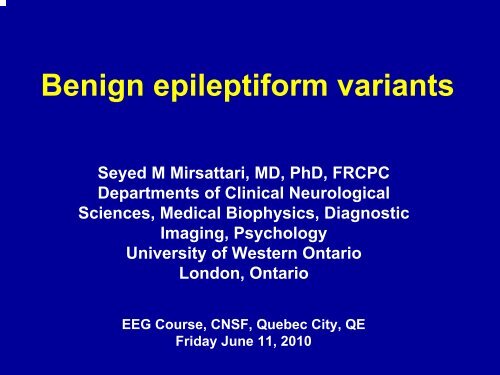 Benign epileptiform variants - Canadian Neurological Sciences ...