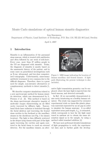 Monte Carlo simulations of optical human sinusitis diagnostics Monte Carlo simulations of optical human sinusitis diagnostics