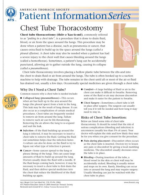 Chest Tube Thoracostomy - Patient Education & ATS PAR
