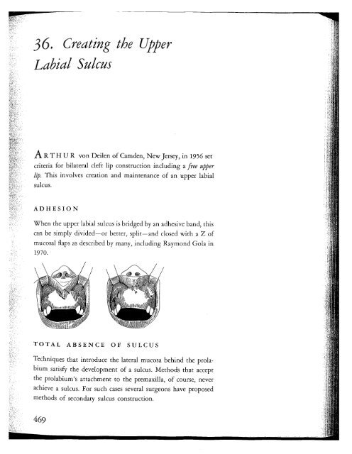 36. Creating the Upper Labial Sulcus 469
