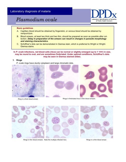 Plasmodium Vivax Slide