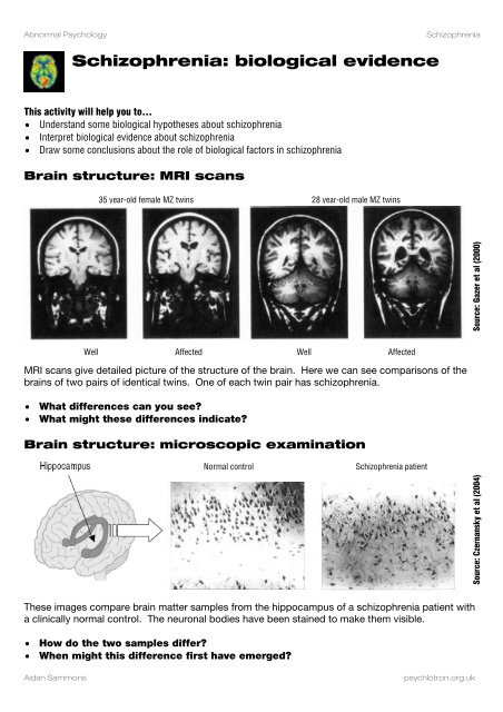Schizophrenia Brain Abnormalities