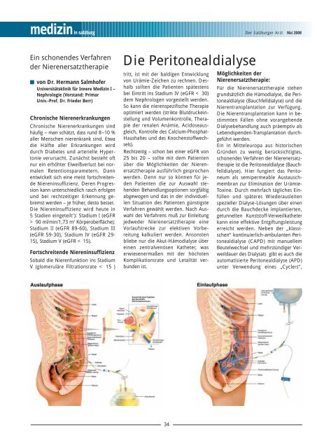 Die Peritonealdialyse - Salk