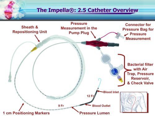 The Impella®