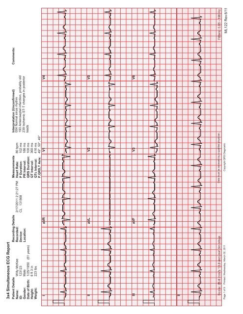 ECG Sample Report - QRS Diagnostic ECG Sample Report - QRS Diagnostic