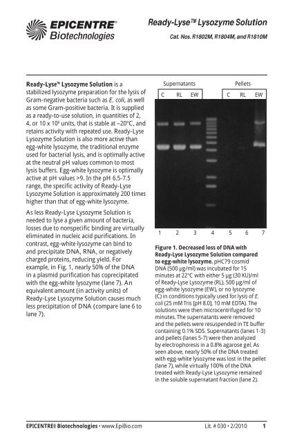 Protocol for Ready-Lyse™ Lysozyme Solution