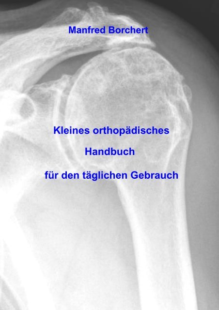 Stenosen der Foramina intervertebralia - NATURHEILKUNDE ...