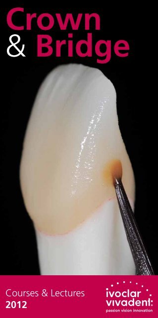 Crown Bridge - Dental CPD