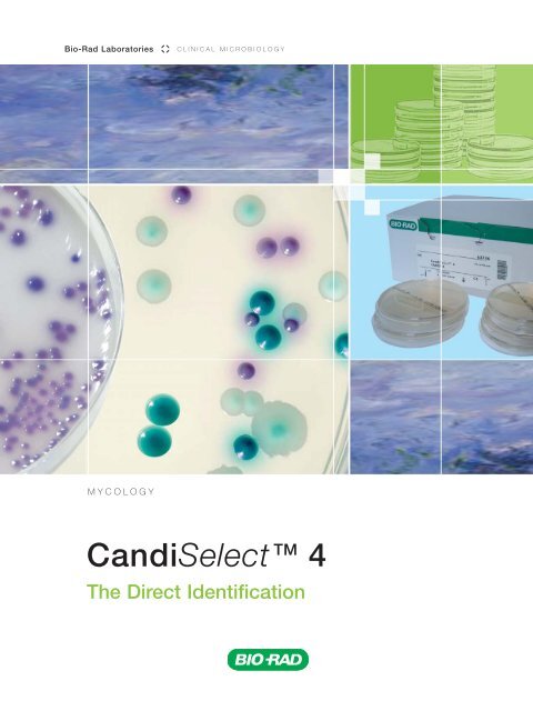 CandiSelectTM 4 The Direct Identification - Did