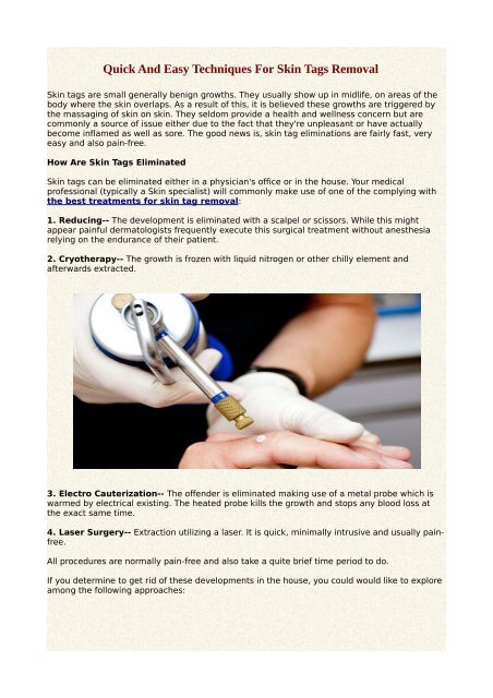 Quick And Easy Techniques For Skin Tags Removal
