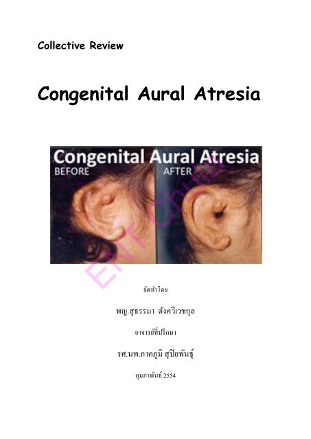 Congenital Aural Atresia