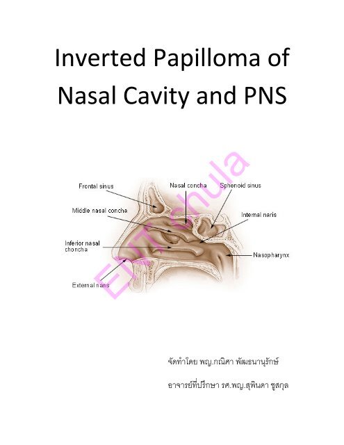 Inverted Papilloma Of Nose Sinus