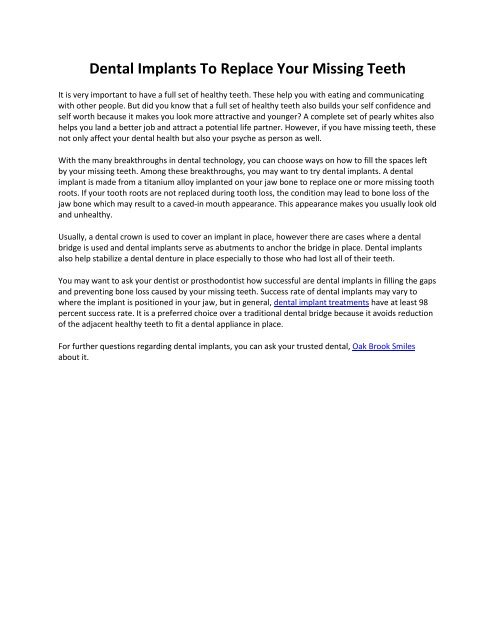 Dental Implants To Replace Your Missing Teeth