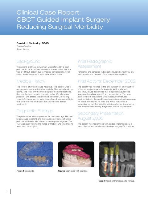 CBCT Guided Implant Surgery Reducing Surgical ... - Nobel Biocare