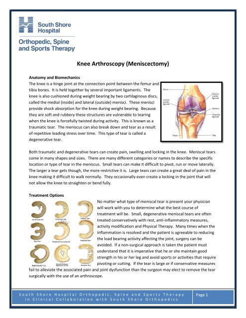 Knee Arthroscopy (Meniscectomy) - South Shore Hospital