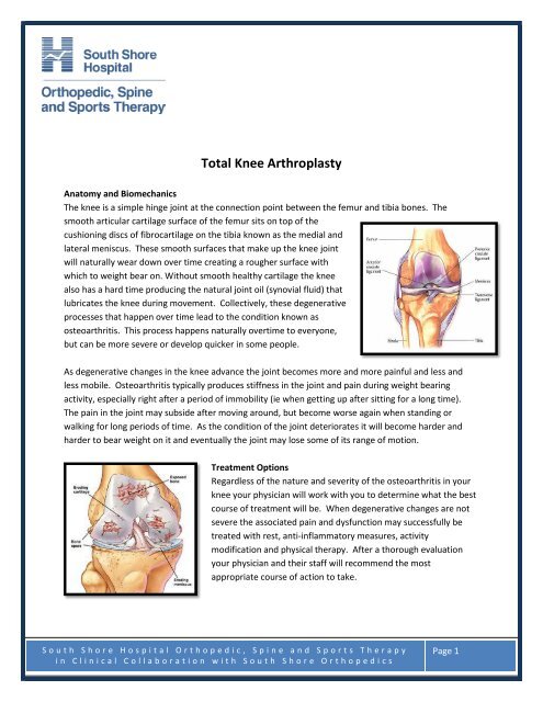 Total Knee Arthroplasty - South Shore Hospital