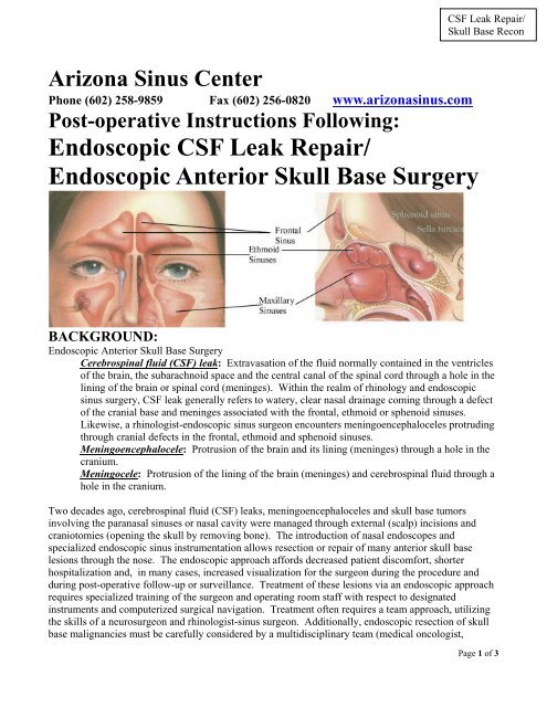 Endoscopic CSF Leak Repair - Arizona Sinus Center