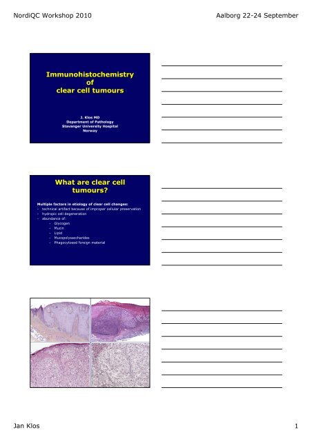 Immunohistochemistry of clear cell tumours What are ... - NordiQC