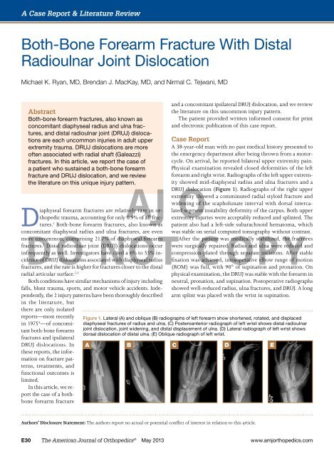Both-Bone Forearm Fracture With Distal Radioulnar Joint Dislocation