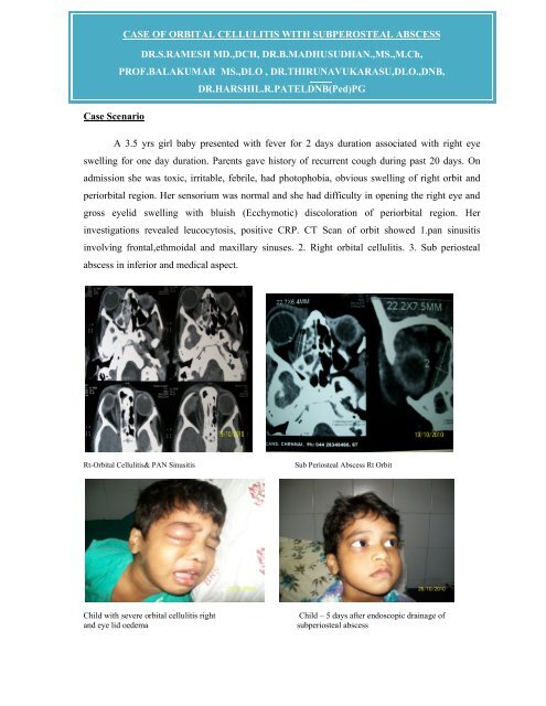 CASE OF ORBITAL CELLULITIS WITH ... - BRS Hospital