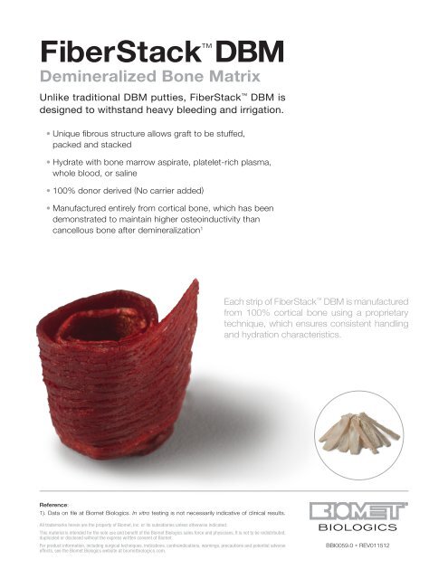 FiberStackÃ¢Â„Â¢ DBM Demineralized Bone Matrix Flyer - Biomet