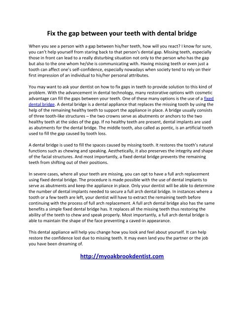 Fix the gap between your teeth with dental bridge