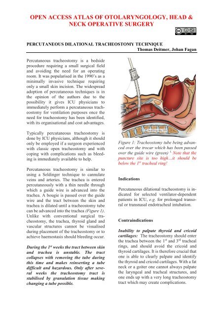 Percutaneous dilational tracheostomy surgical technique