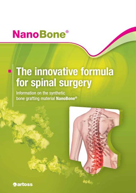 NanoBone Â® Spine Brochure - ARTOSS GmbH
