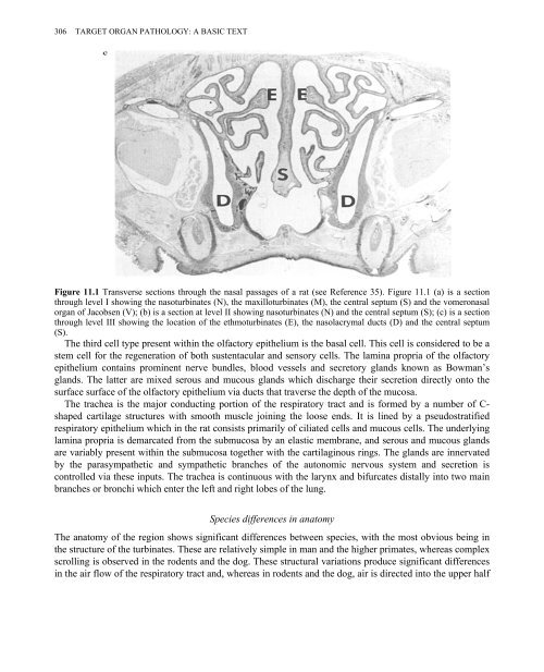 TARGET ORGAN PATHOLOGY: A