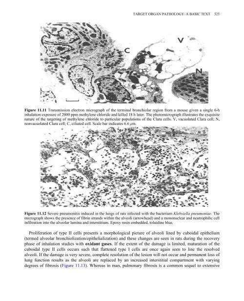 TARGET ORGAN PATHOLOGY: A