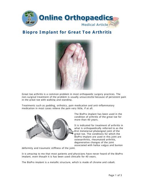 Biopro Implant for Great Toe Arthritis