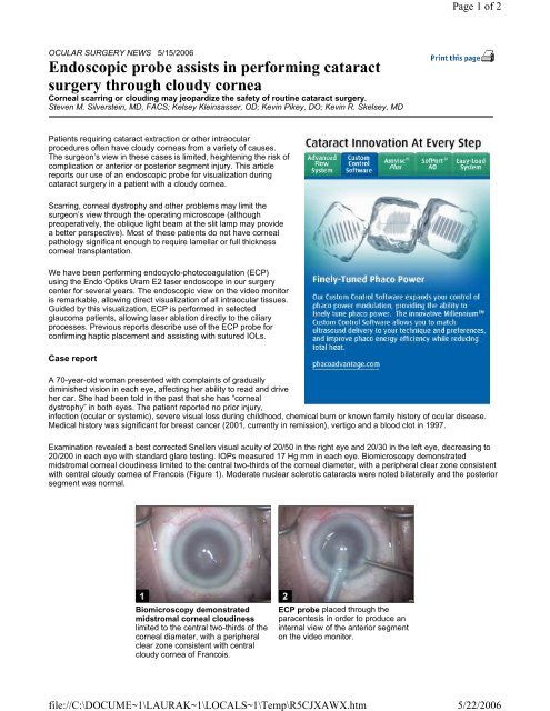 Endoscopic probe assists in performing cataract ... - Endo Optiks