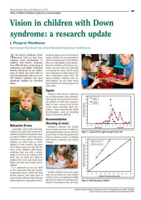 Vision in children with Down syndrome: a research update