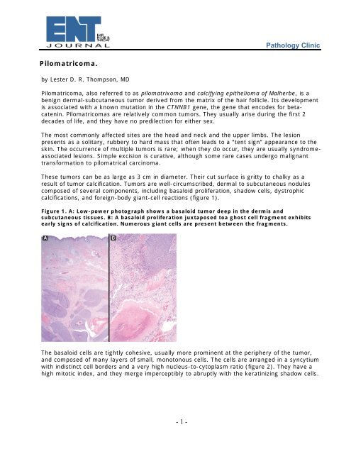 1 MB .pdf - Lester Thompson