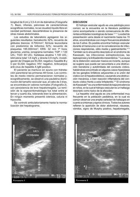 VOL. 96/1998 HIDROPS VESI