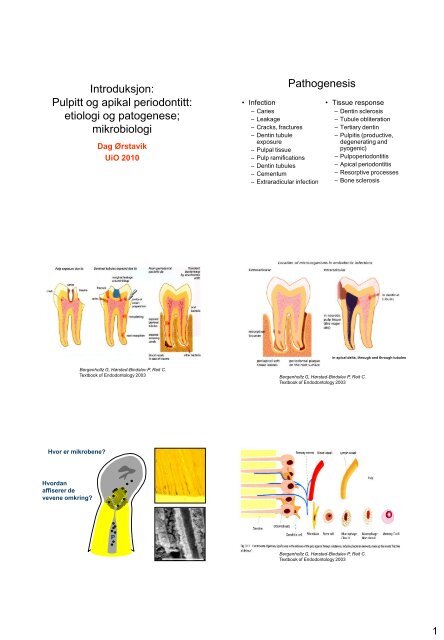 Introduksjon: Pulpitt og apikal periodontitt: etiologi og patogenese ...