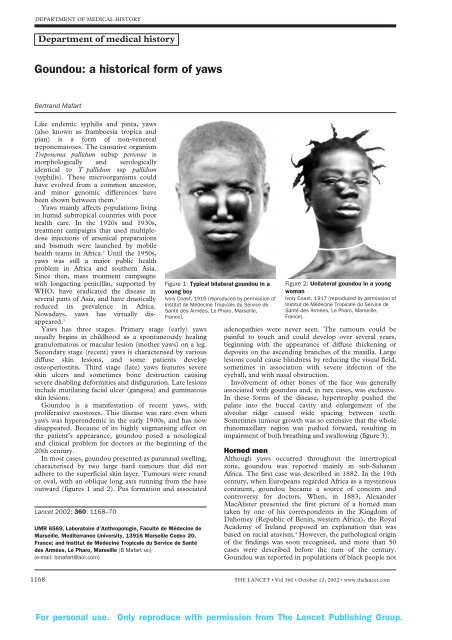 Goundou: a historical form of yaws - Mafart, Bertrand - Free