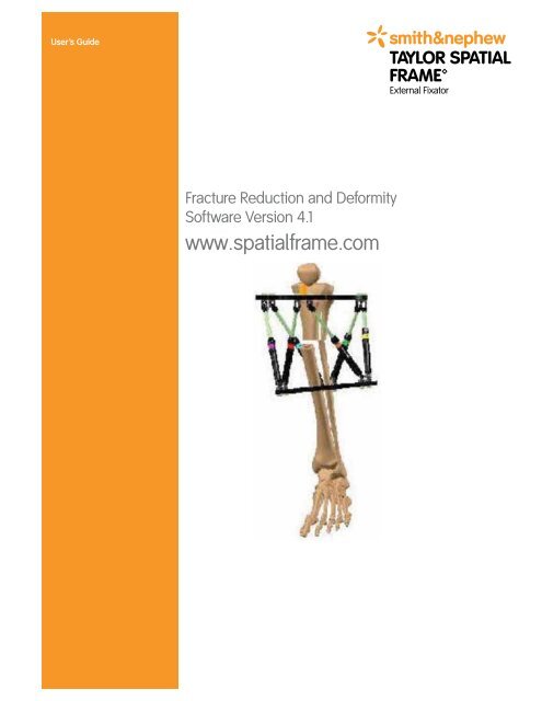 Taylor Spatial Frame Software Guide.pdf - Bonerepmedical.com