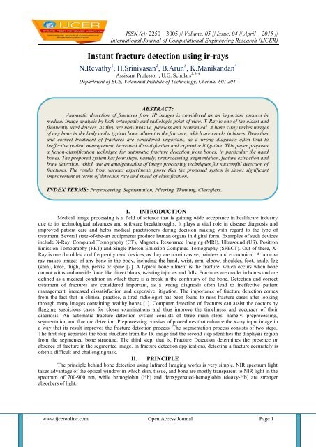 Instant fracture detection using ir-rays