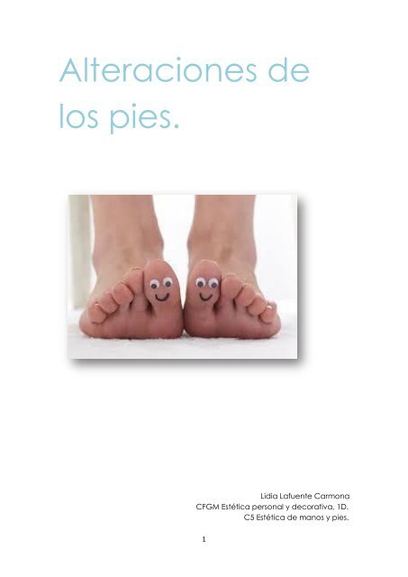 Alteraciones de los pies.