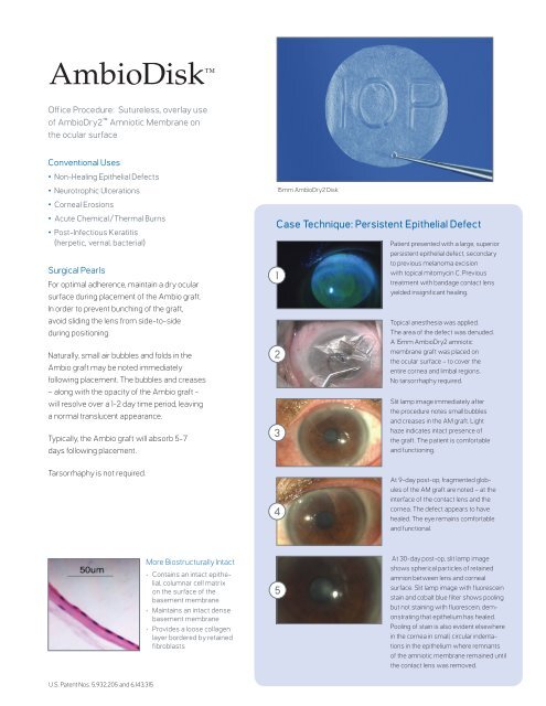 AmbioDiskâ ¢ - IOP Inc.
