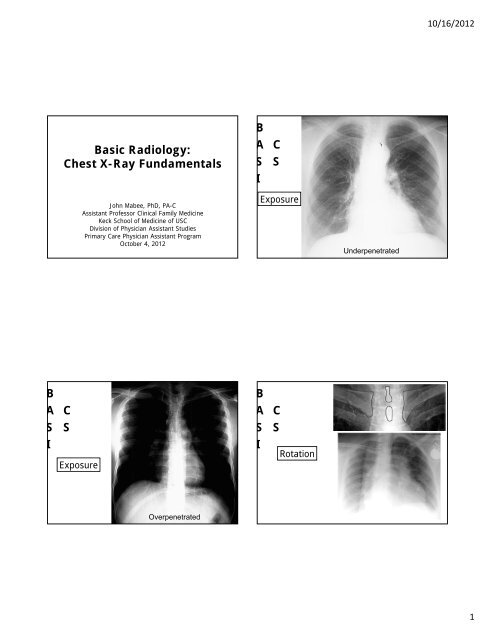 Basic Radiology: Chest X-Ray Fundamentals BASICSBASICSBASICS