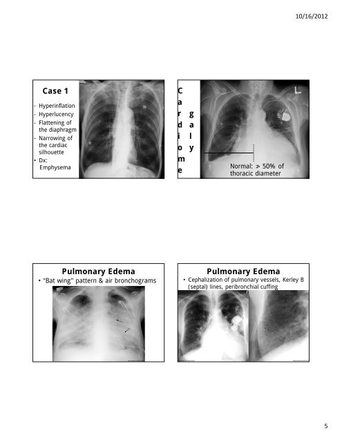 10/16/2012 Emphysema
