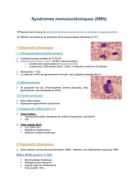 29-Syndromes mononuclÃ©osiques - PharmaEtudes