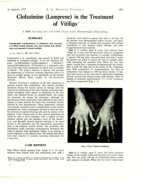 (Lamprene) in the Treatment of Vitiligo - Sabinet Reference