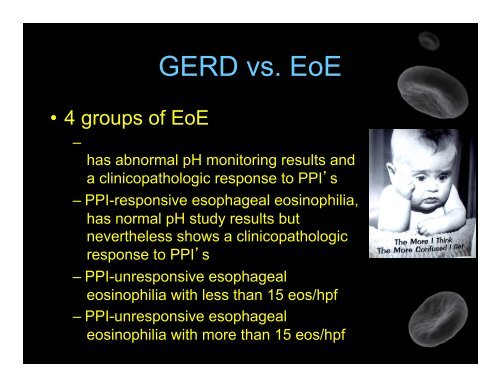 GERD vs.EoE• Recommenda